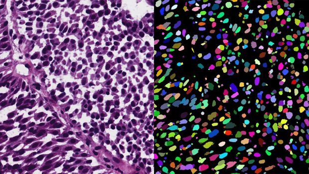 Microscopy image segmentation via point and shape regularized data synthesis | NYU Tandon School ...
